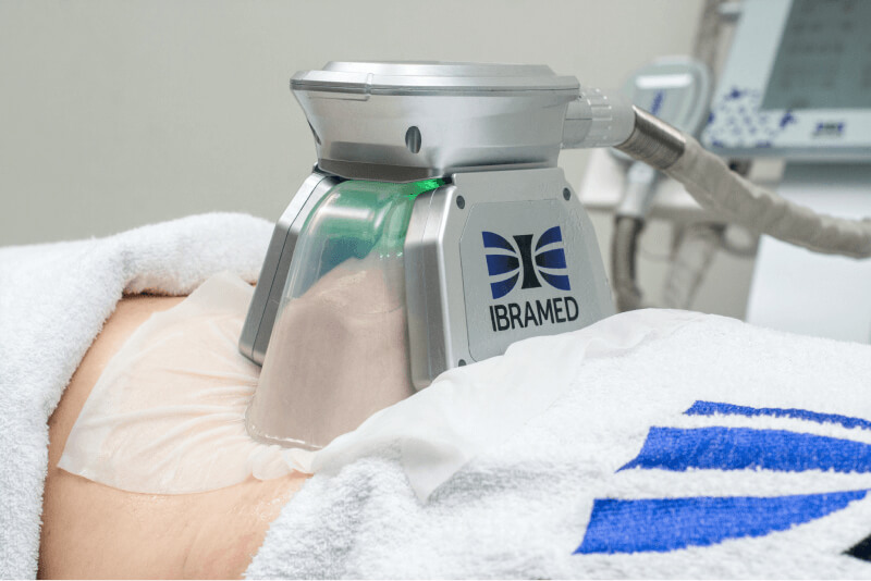 Criolipólise Polarys Ibramed – Transforme-se!